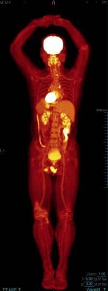 Types of Medical Scanners used in diagnostic imaging| Open Medscience