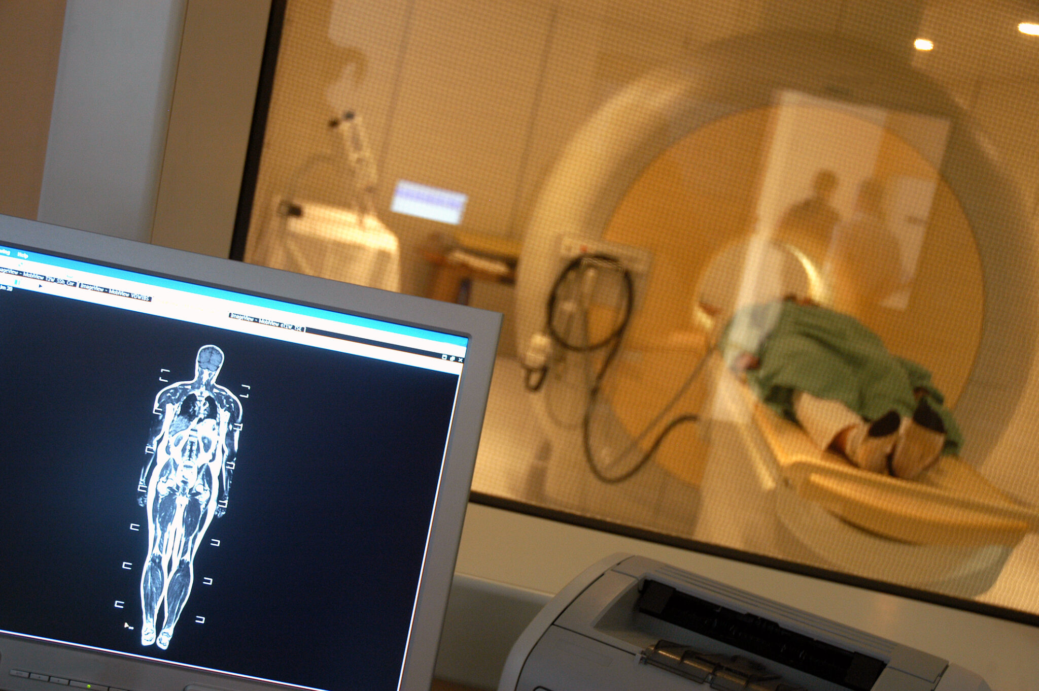 Exploring the Field of Medical Health Physics | Open Medscience