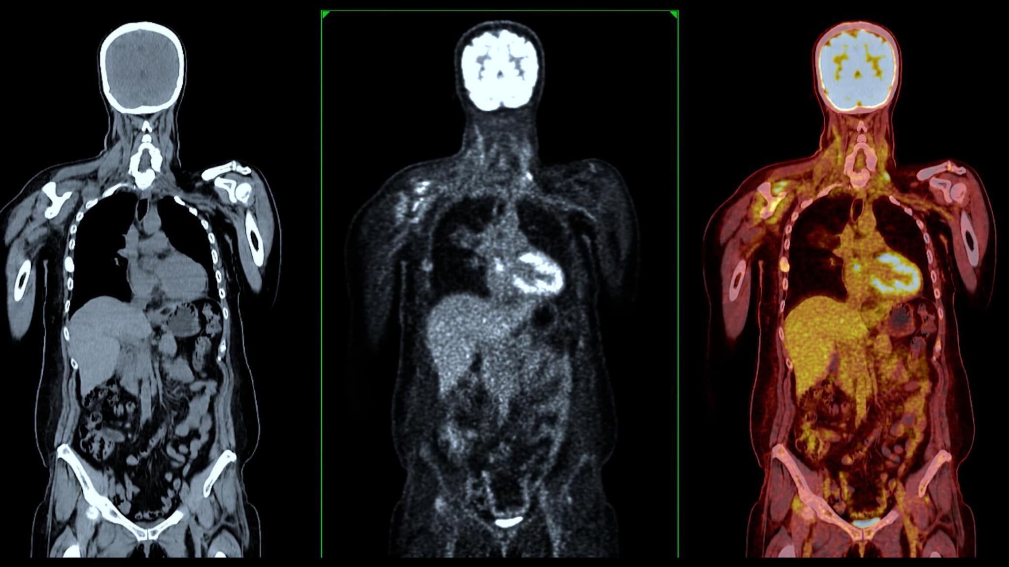 Medical Imaging Modalities for Diagnosis | Open Medscience