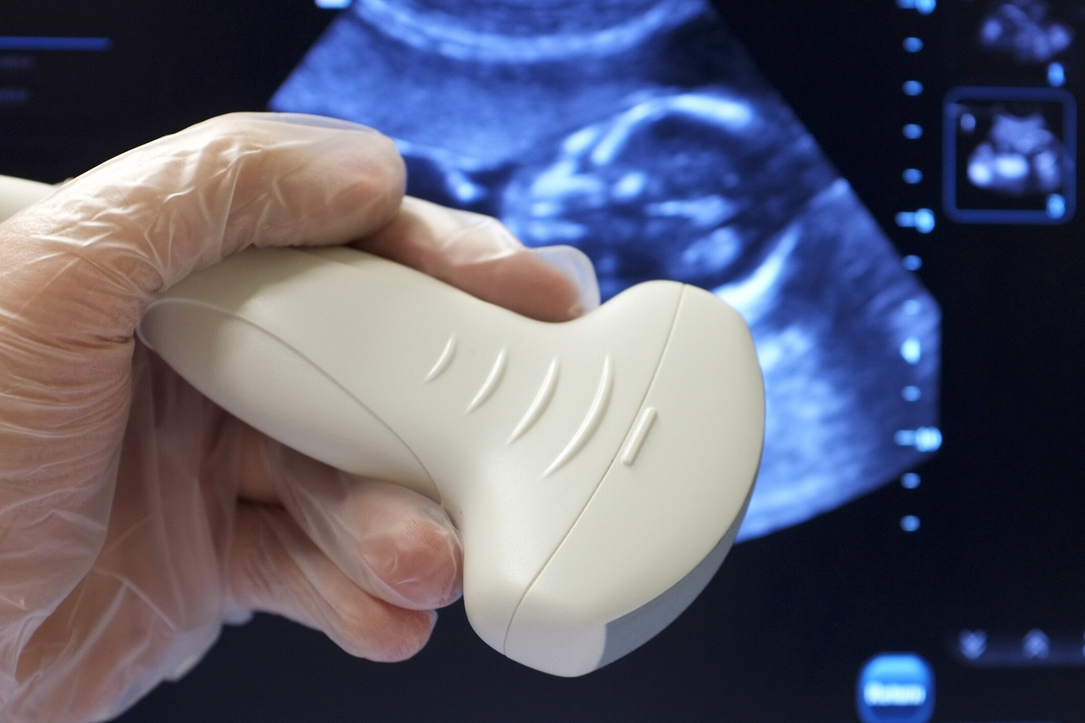 Ultrasonography is ultrasound imaging | Open Medscience