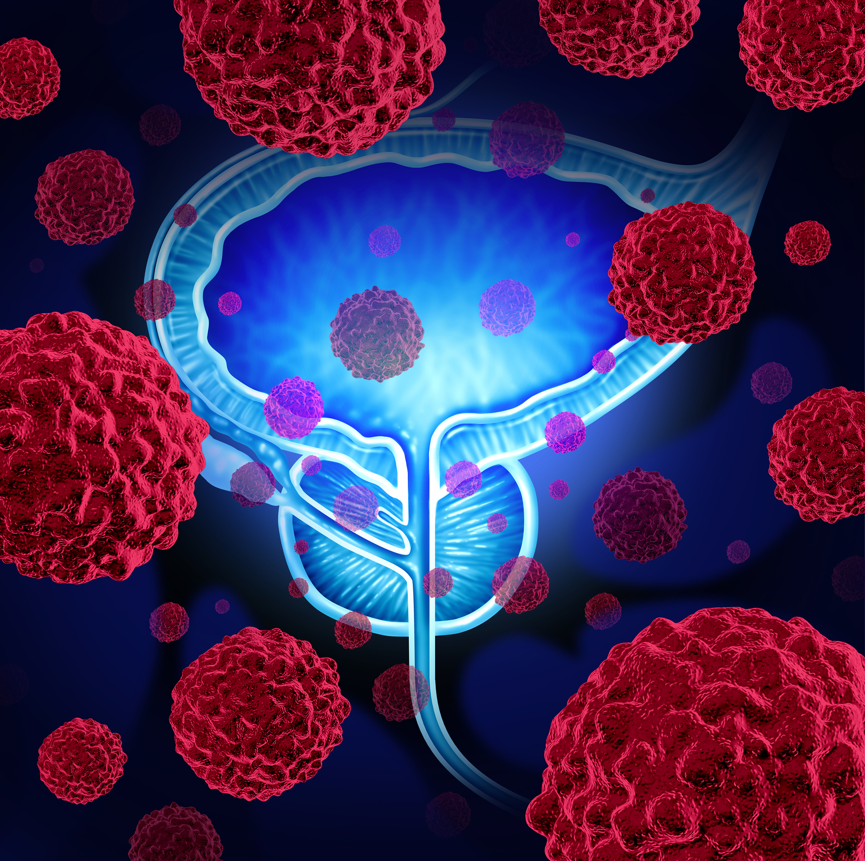 PSMA targeting agents for prostate cancer | Open Medscience