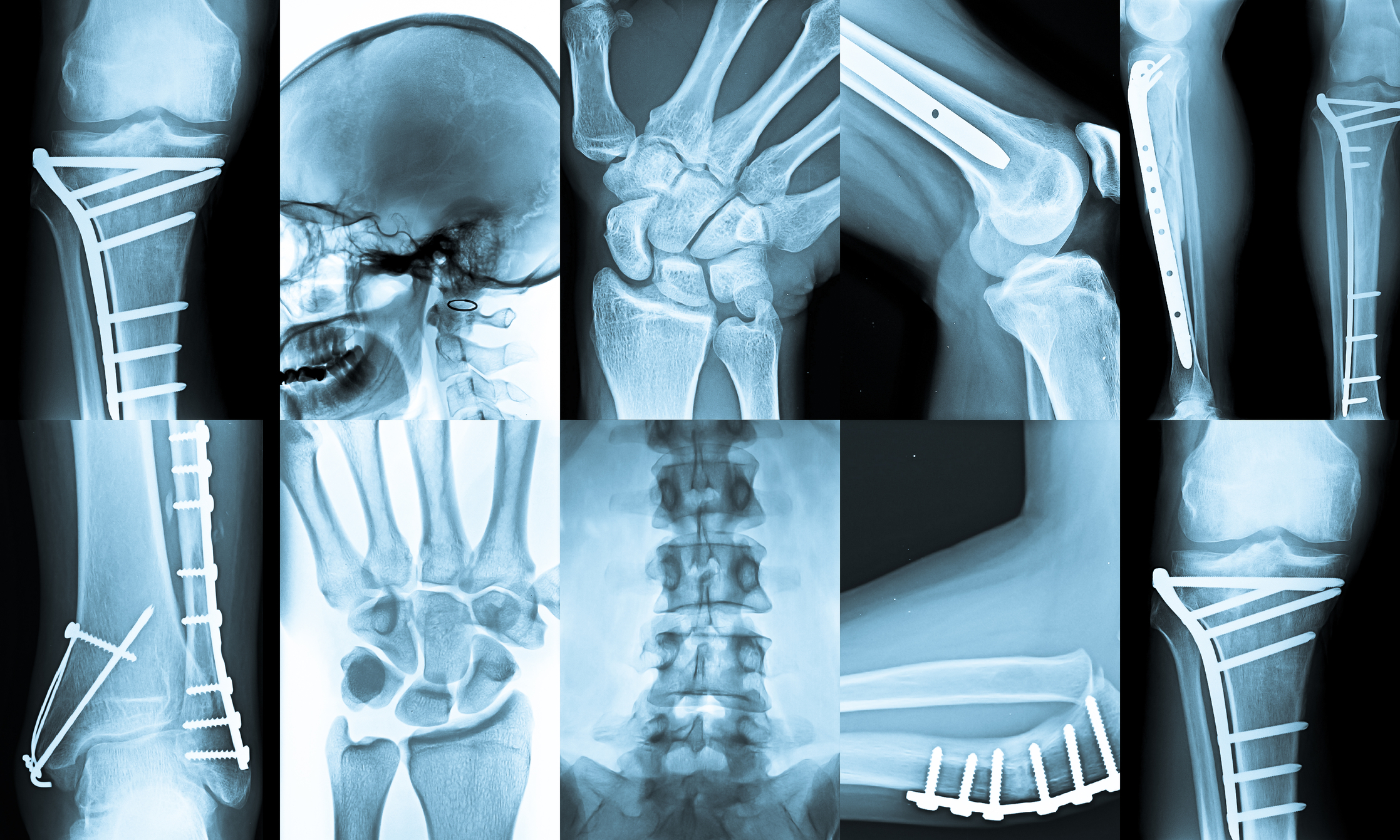 Medical X-rays: A Century of Clinical Innovation | Open Medscience